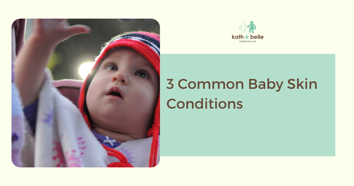 Kath + Belle | 3 Common Baby Skin Conditions